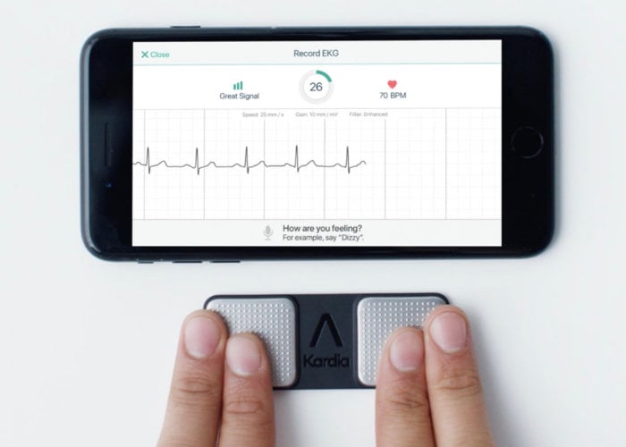 KardiaMobile smartphone ECG monitor detects Atrial Fibrillation ...